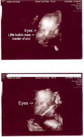 Pregnancy: Week 32 - All Things G&D